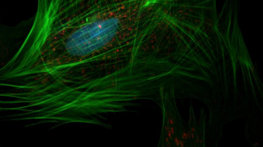 Adarma Announces Neurodiversity Strategy in Partnership with Scottish ...